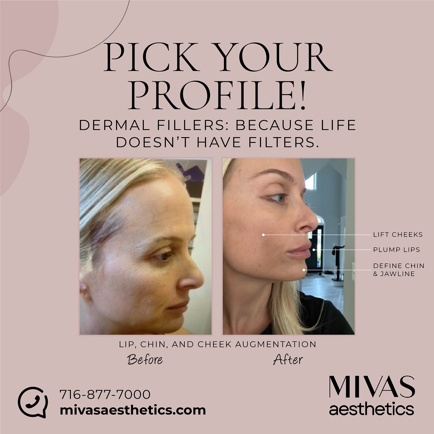 Pick YOUR Profile - MIVAS aesthetics